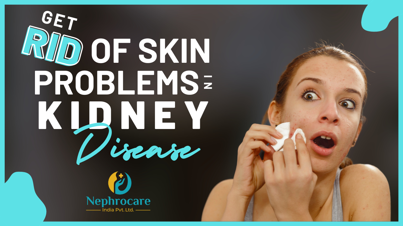 Skin problems in Kidney Disease: Unlocking the Connection - Best ...