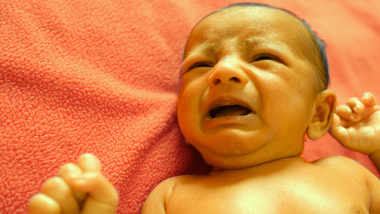 Neonatal Jaundice: Why Do Newborns Turn Yellow?